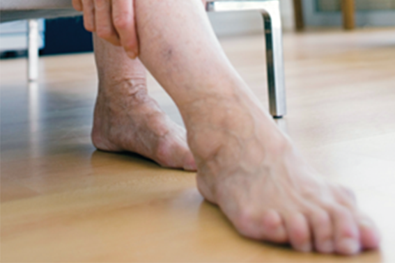 Homeopathy For Blood Circulation DrHomeo Homeopathy Homeopathy For Blood Circulation DrHomeo Homeopathy
